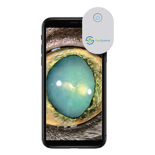 QUIKVUE® PLUS SMARTPHONE EYE IMAGING ADAPTER (2ND GENERATION ...